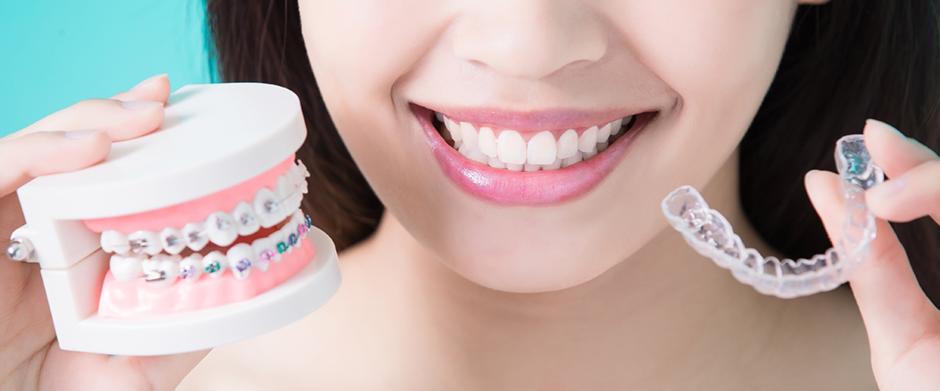 Affordable Alternatives to Invisalign Clear Braces