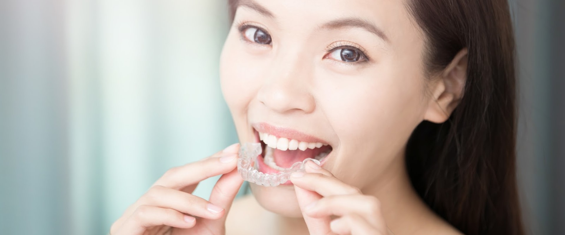 Achieve A Perfect Smile With Invisalign Clear Braces: Your Guide To ...